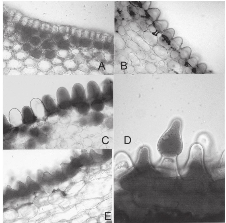 “ig. 4. various shapes of upper epidermal cells found in the