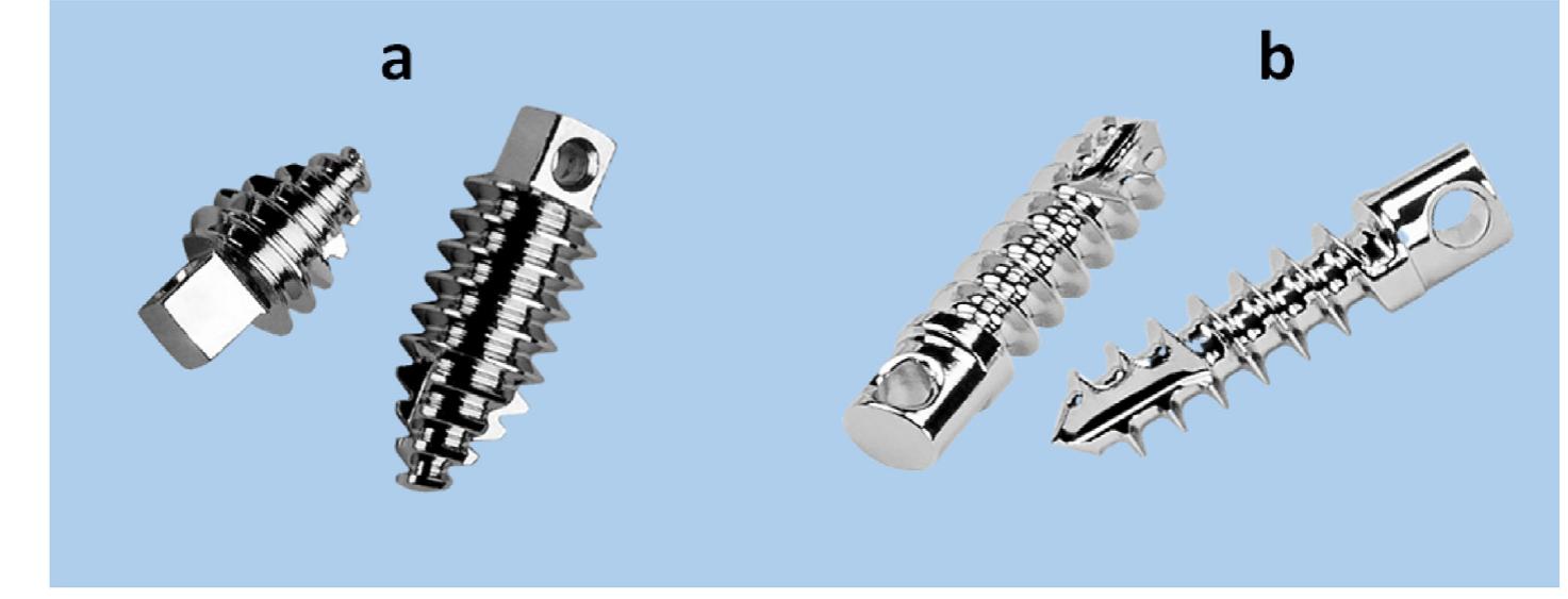 Figure 6 - from Biodegradable metallic suture anchors: A