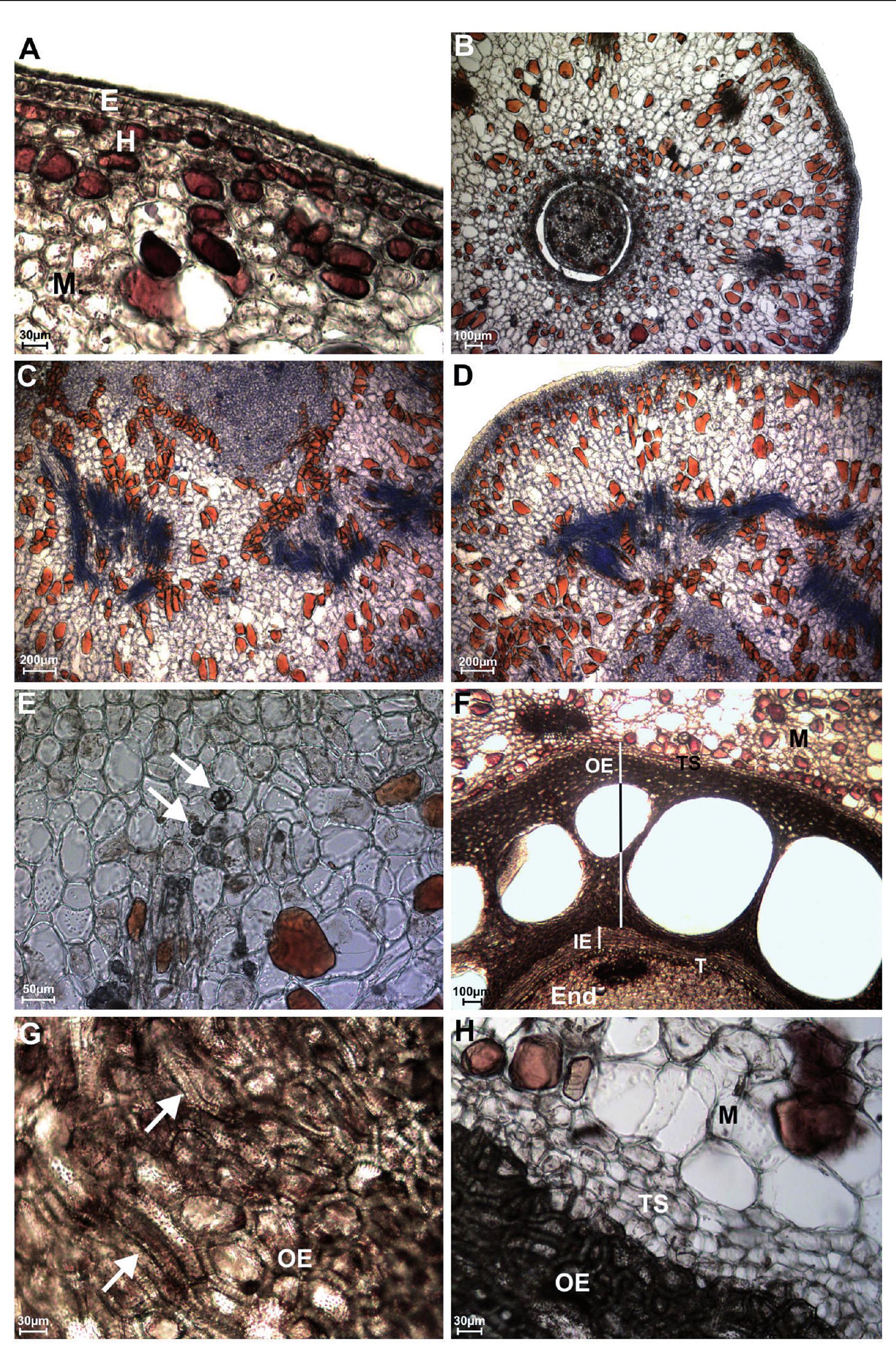 Anatomical pericarp sections of cornus mas, c. officinalis,