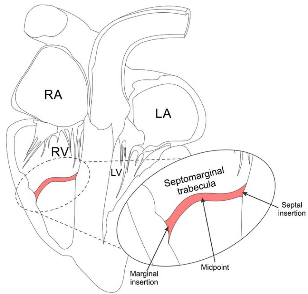 Schematic illustration demonstrating the sites of