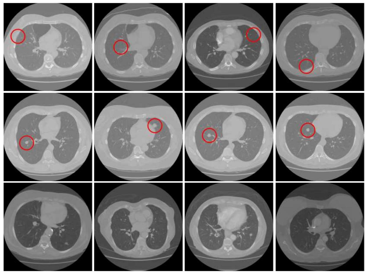 Raw ct scan images with tampered regions circled authors of