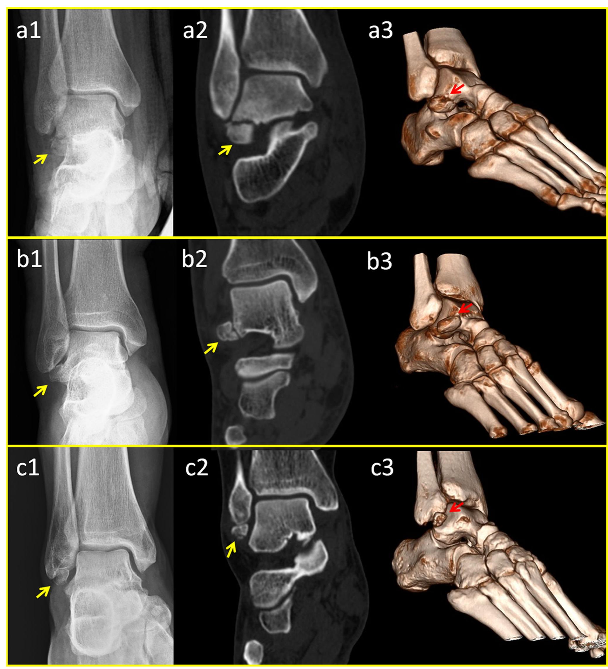 And 3d reconstructions (a3, b3, c3) the location and