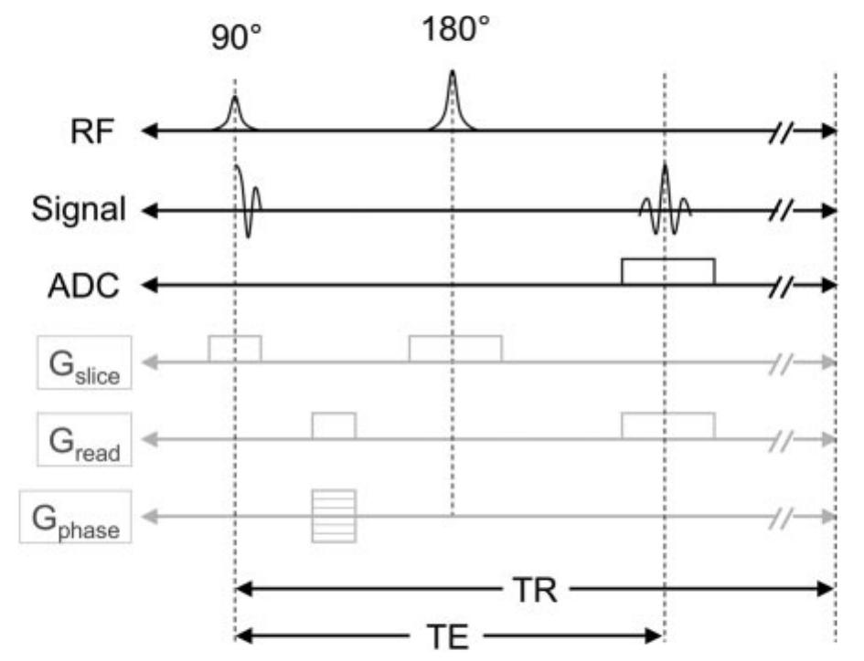 Pulse sequence diagram. a pulse se- quence diagram can be