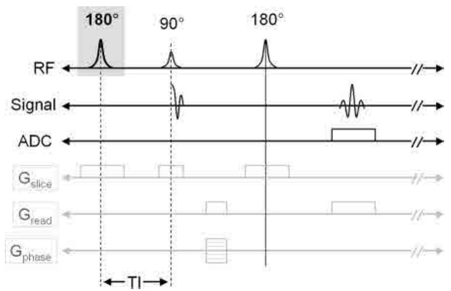 Inversion-recovery pulse sequence. this sequence is similar