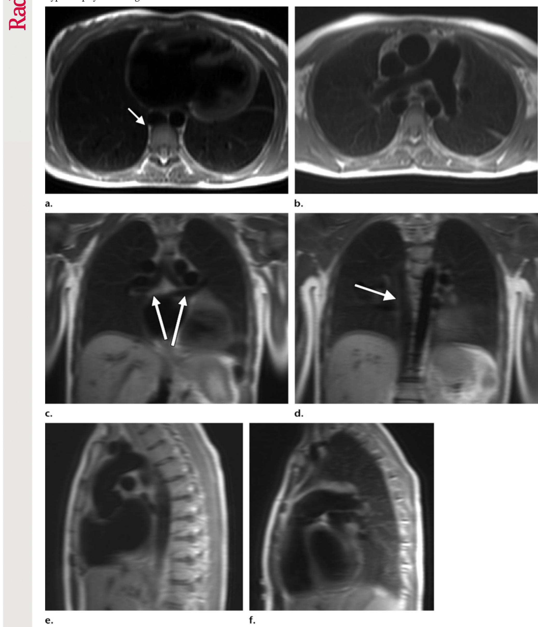 Figure 4 - Segmental Approach to Imaging of Congenital Heart