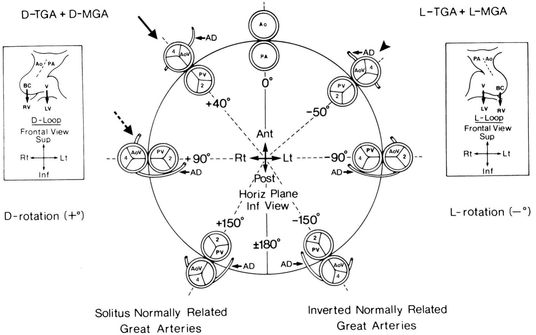 Schema shows the spectrum of possible configurations of the