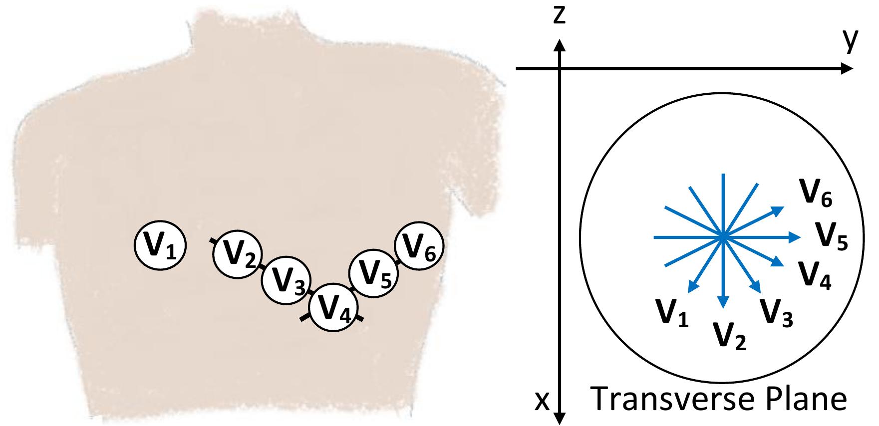 Illustration of the electrode locations for the six