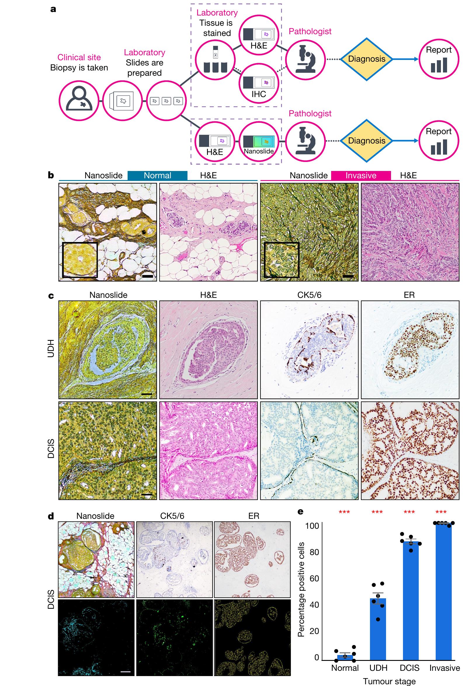 | nanoslide histology images and pathology assessment of