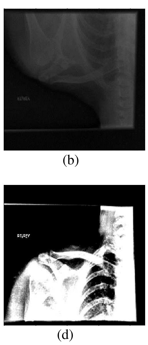Figure 1 - Bone X-Rays Classification and Abnormality