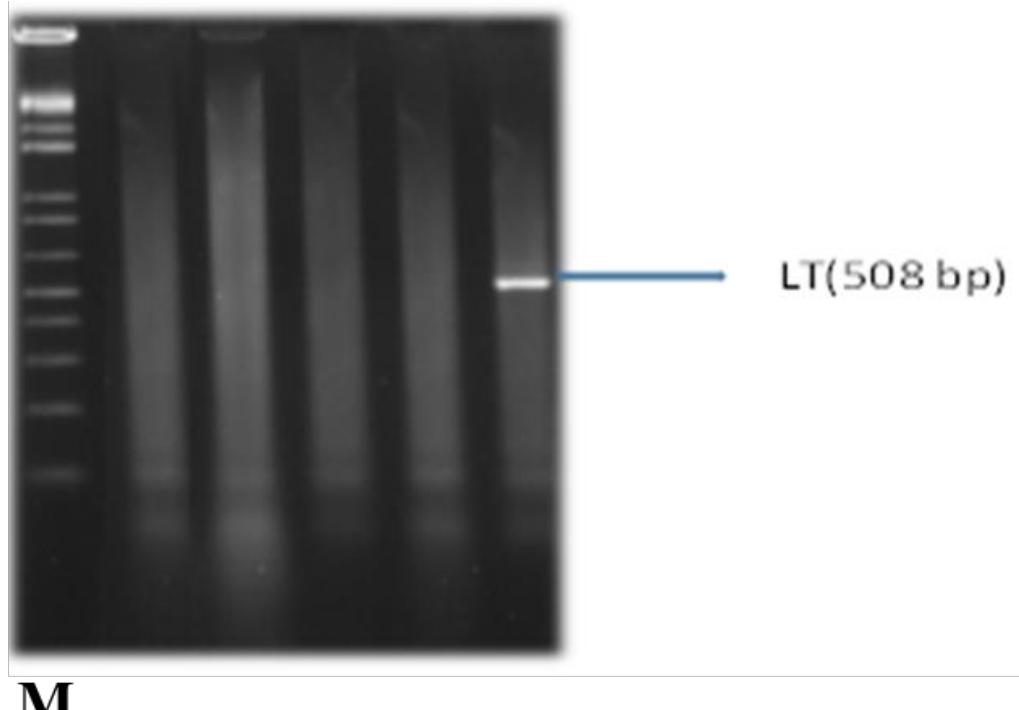 Agarose gel electrophoresis showing the pcr amplification