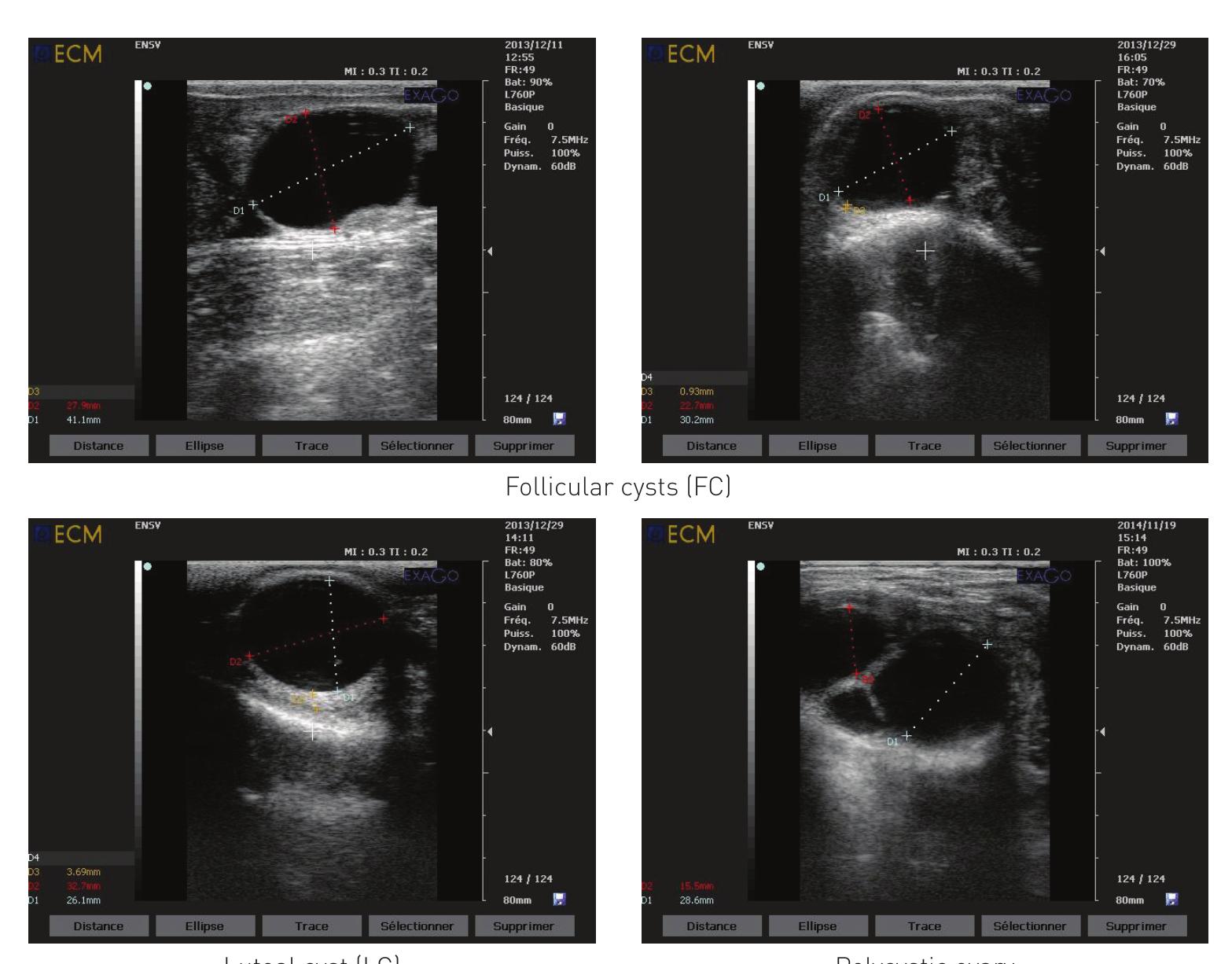 Ultrasound examination of the different types of ovarian