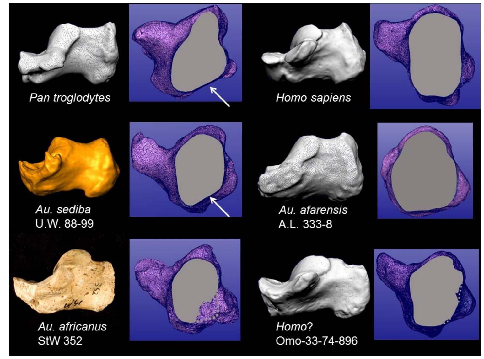 Figure 14 - The Foot and Ankle of Australopithecus sediba
