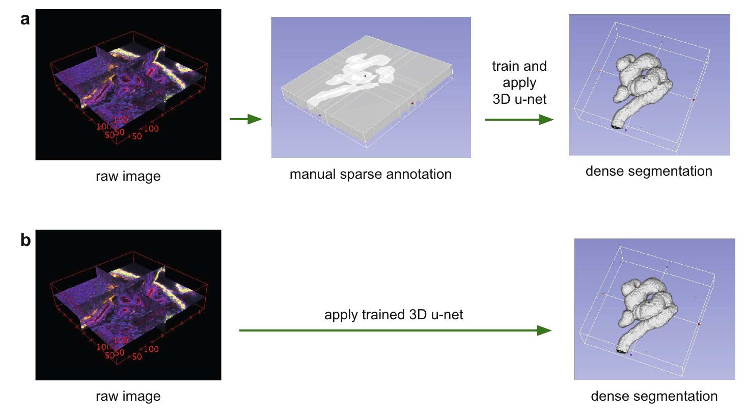 Application scenarios for volumetric segmentation with the