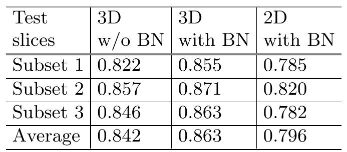 Table 1 - 3D U-Net: Learning Dense Volumetric Segmentation