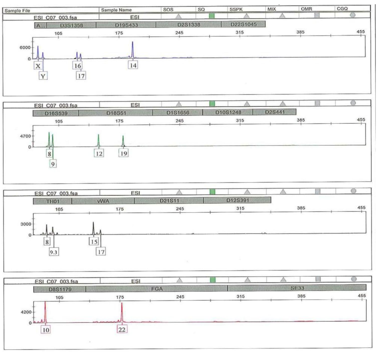 Powerplex esi® 17 kit partial profile generated from a 20
