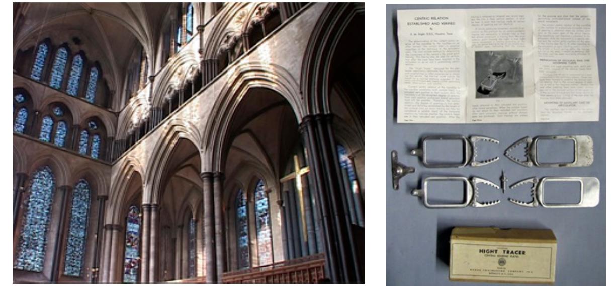 Figure 4 - An insight into gothic arch tracing