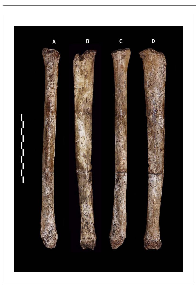 U.w. 101-484 paratype tibia. (a) anterior view; (b) medial