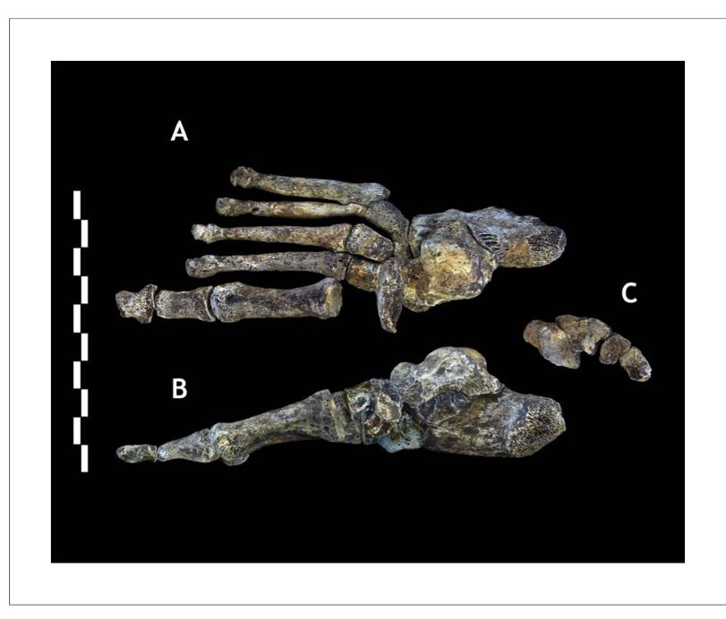 Foot 1 in (a) dorsal view; and (b) medial view. (c) proximal