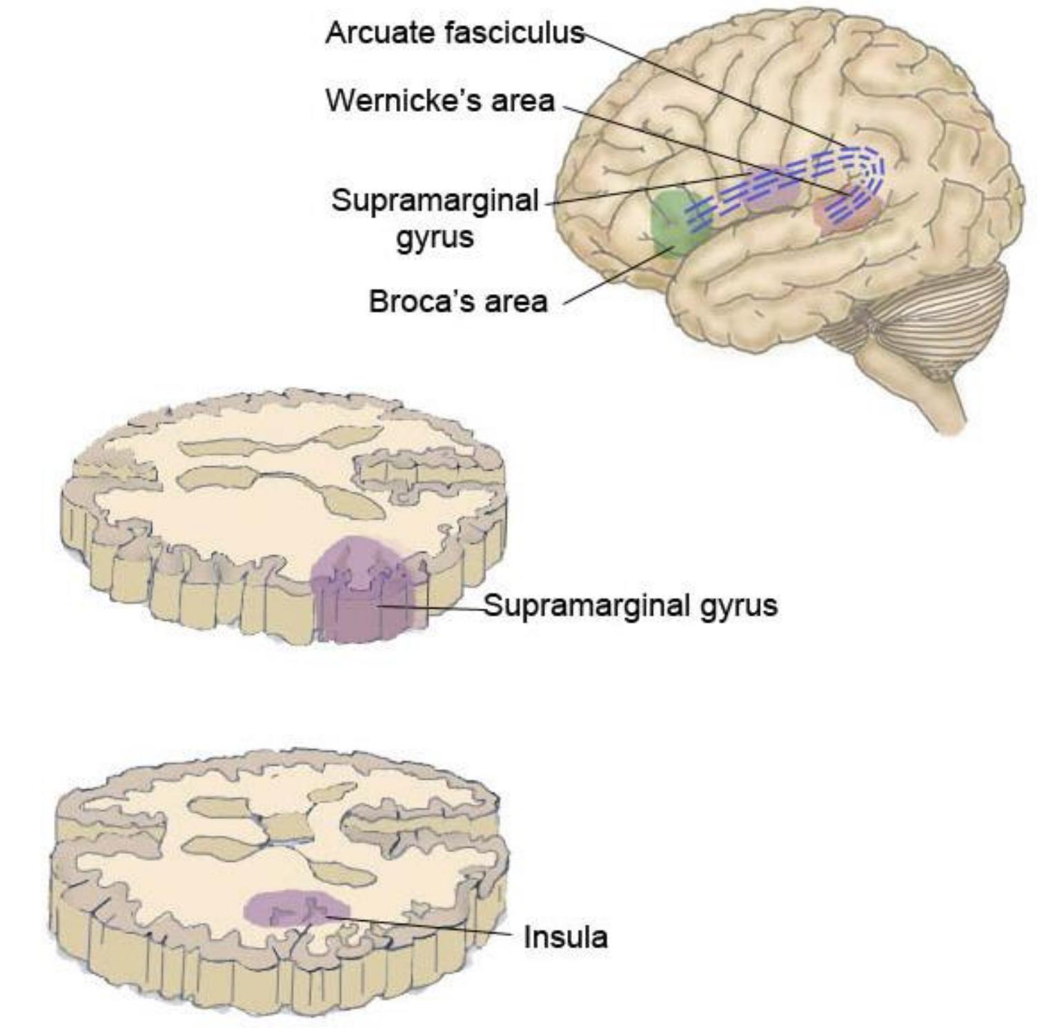 Anatomical representation of conduction aphasia