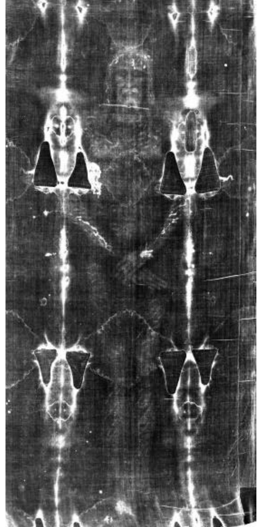 Figure 2 - Is The Shroud of Turin a Medieval Photograph ? A