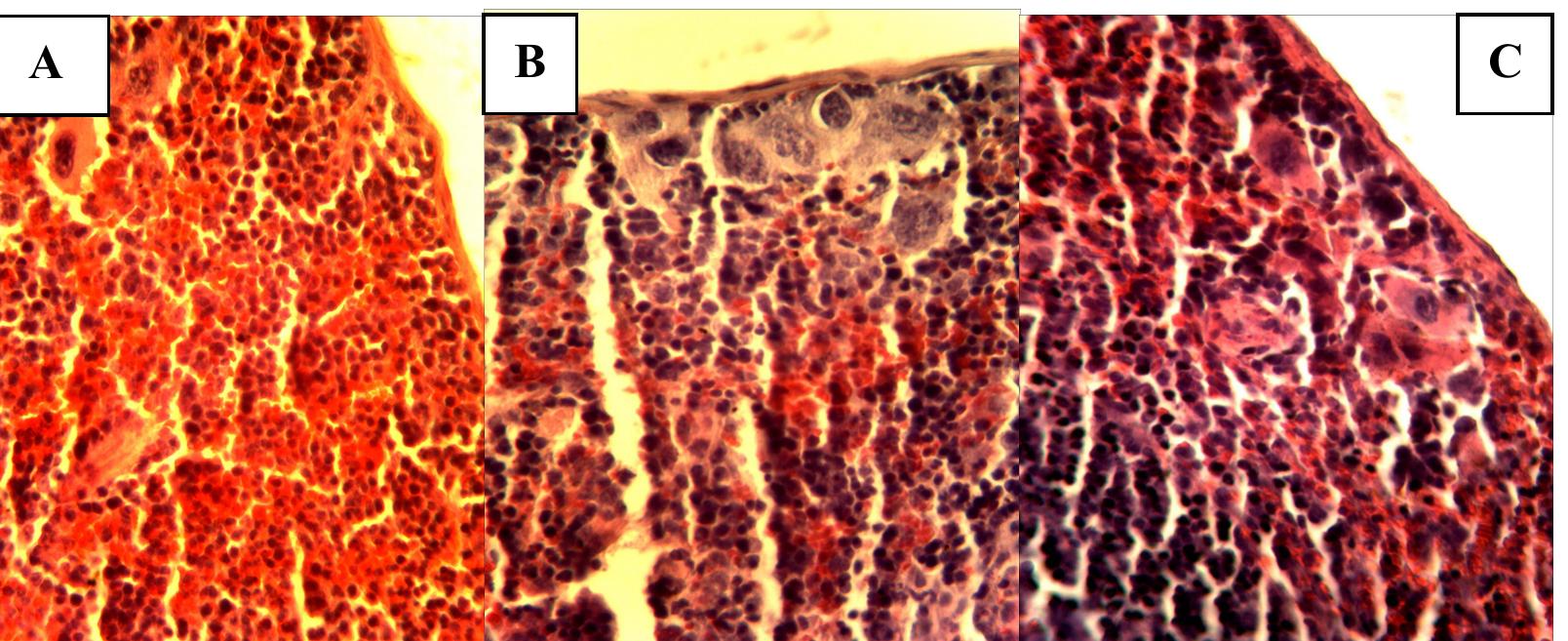 Histopathology of red pulp of spleen of balb/c mice infected