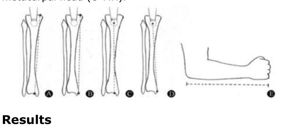 Illustration of anthropometric parameters measured (a)