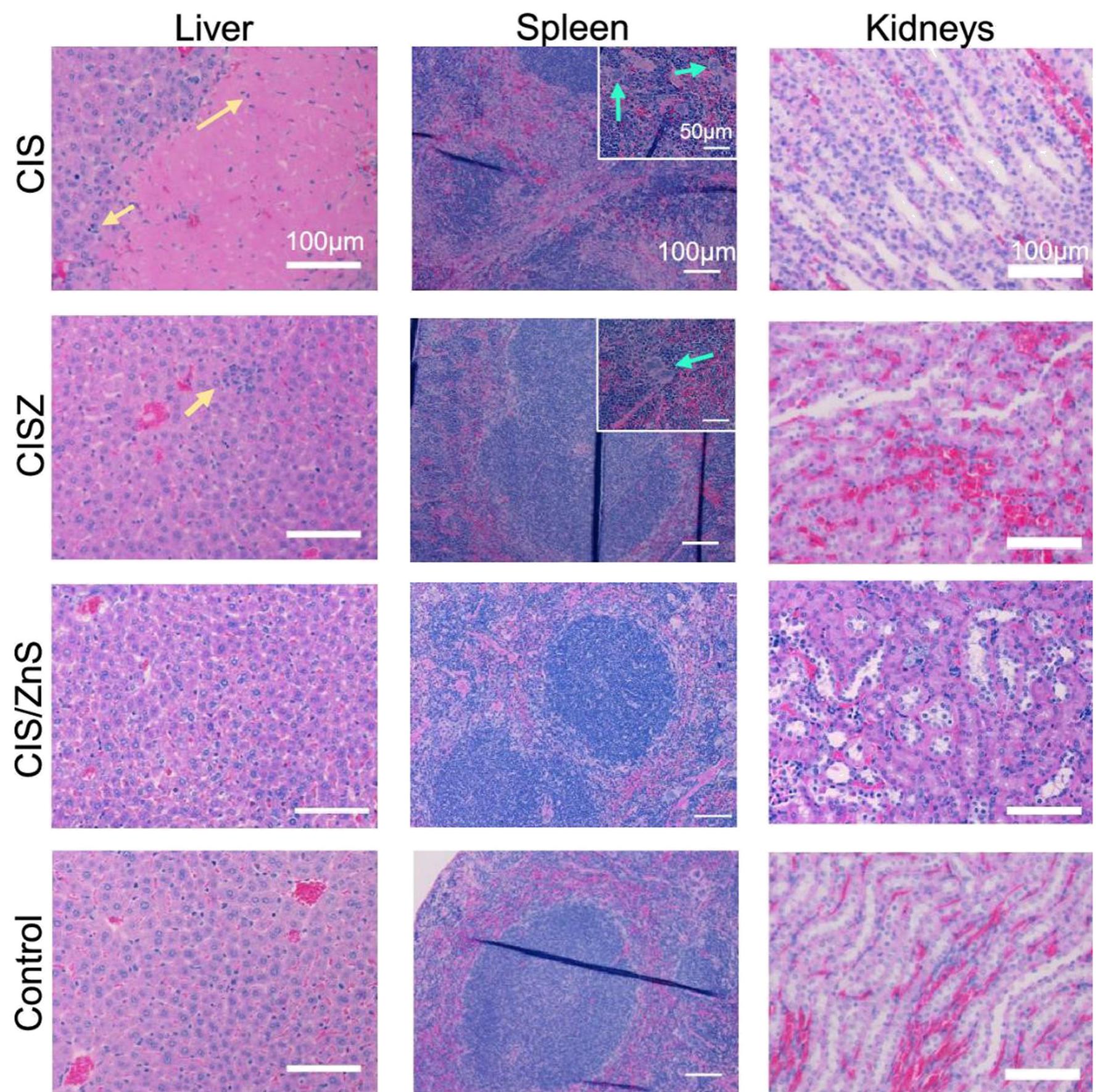 Micrograph of the organs (liver, spleen, and kidney) in the