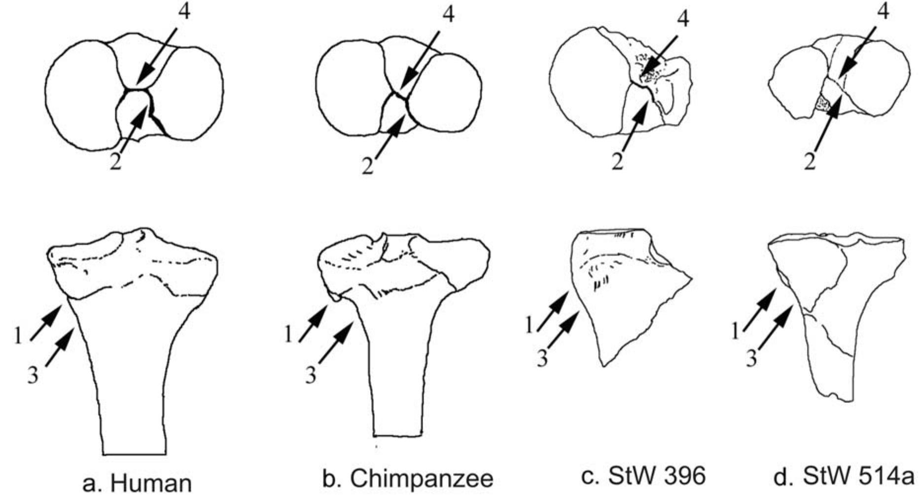 Dorsal and posterior views of proximal tibiae. the