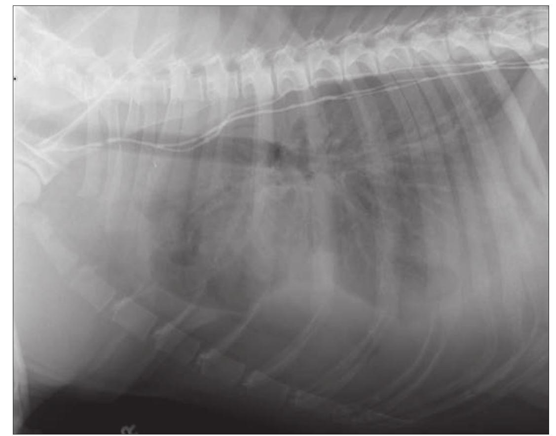 Lateral thoracic radiograph after contrast lymphangiography
