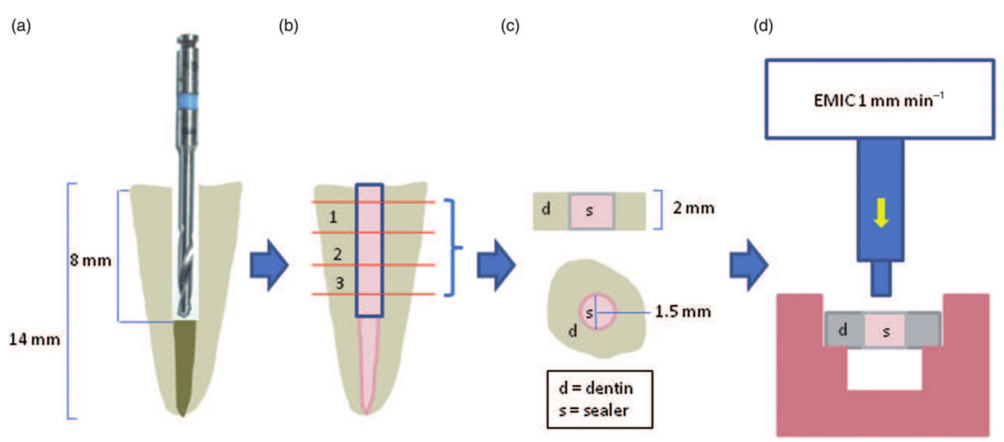 (a) diagram of the root canal preparation using a