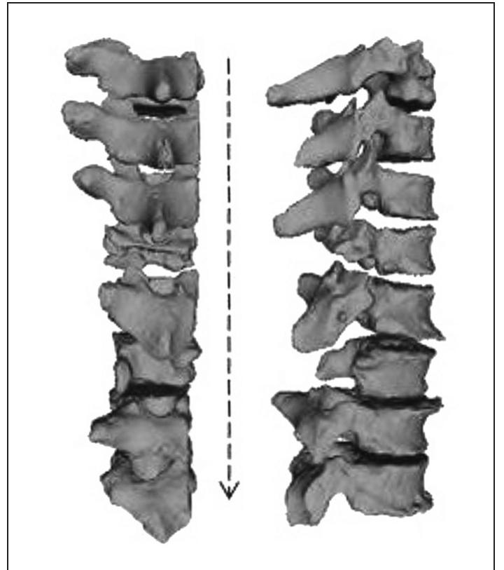 Iii vil6 3-d scan of t1-t8 showing uniformity of the cut.