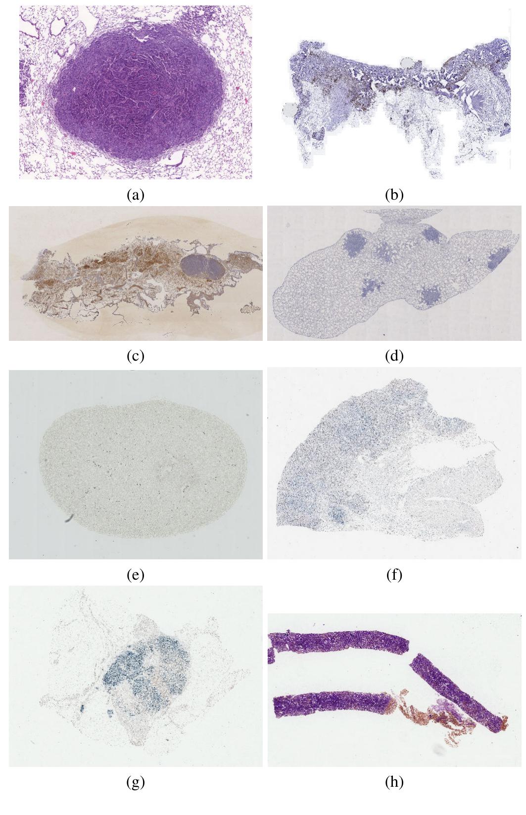 Example dataset images: (a) lung lesions, (b) coad (colon