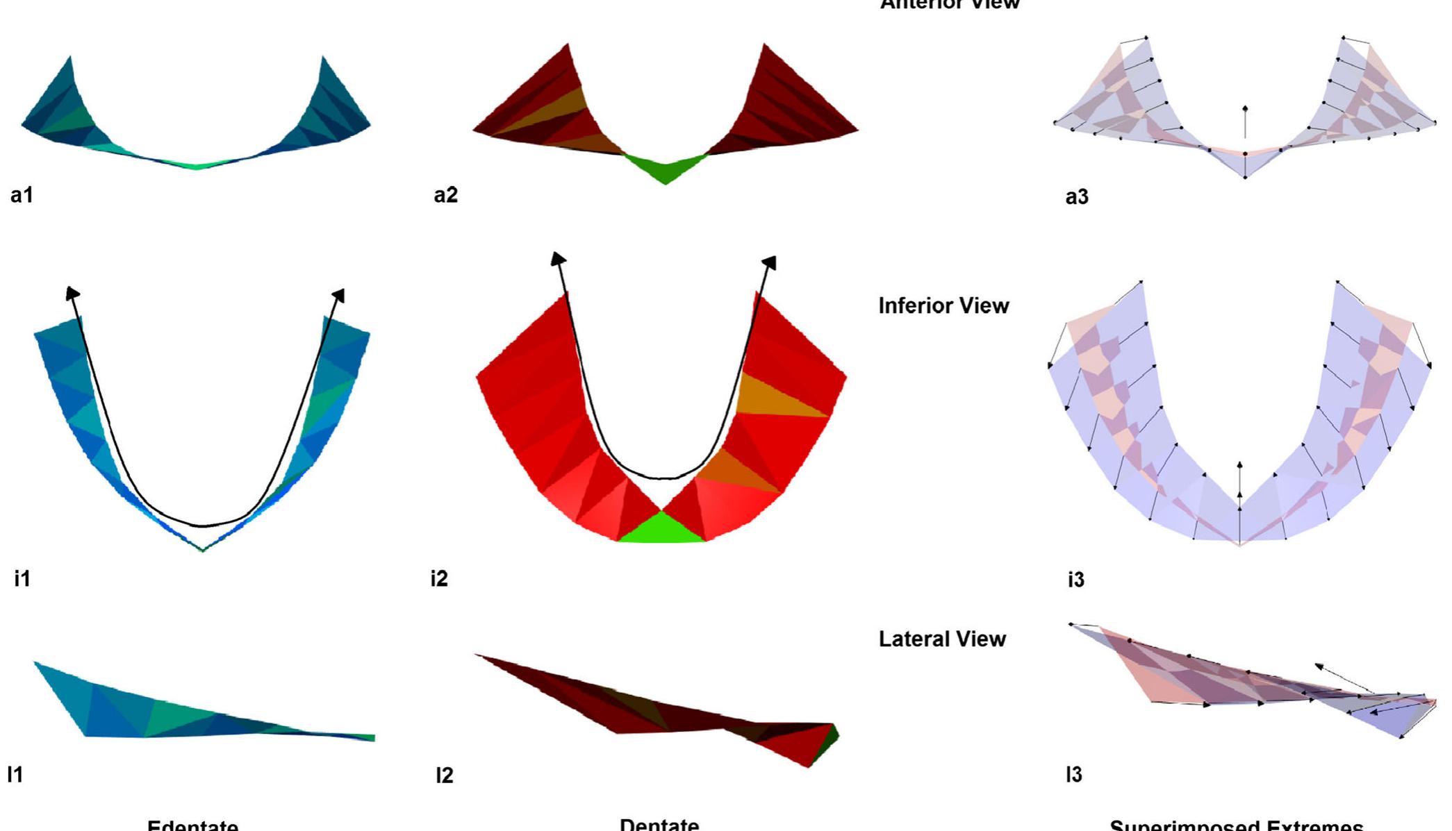 Anterior, inferior and lateral coloured side by side