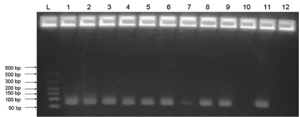 Typical agarose gel electrophoresis of pcr products