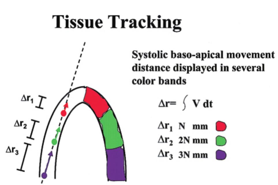Schematic drawing of the principle of tissue tracking. the