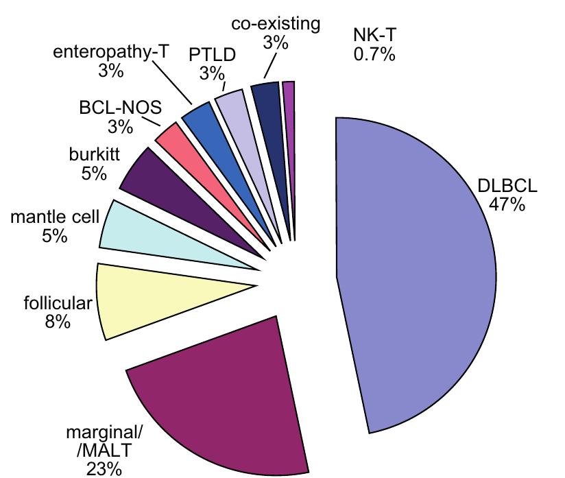 Gastrointestinal lymphoma distribution fig. 1.