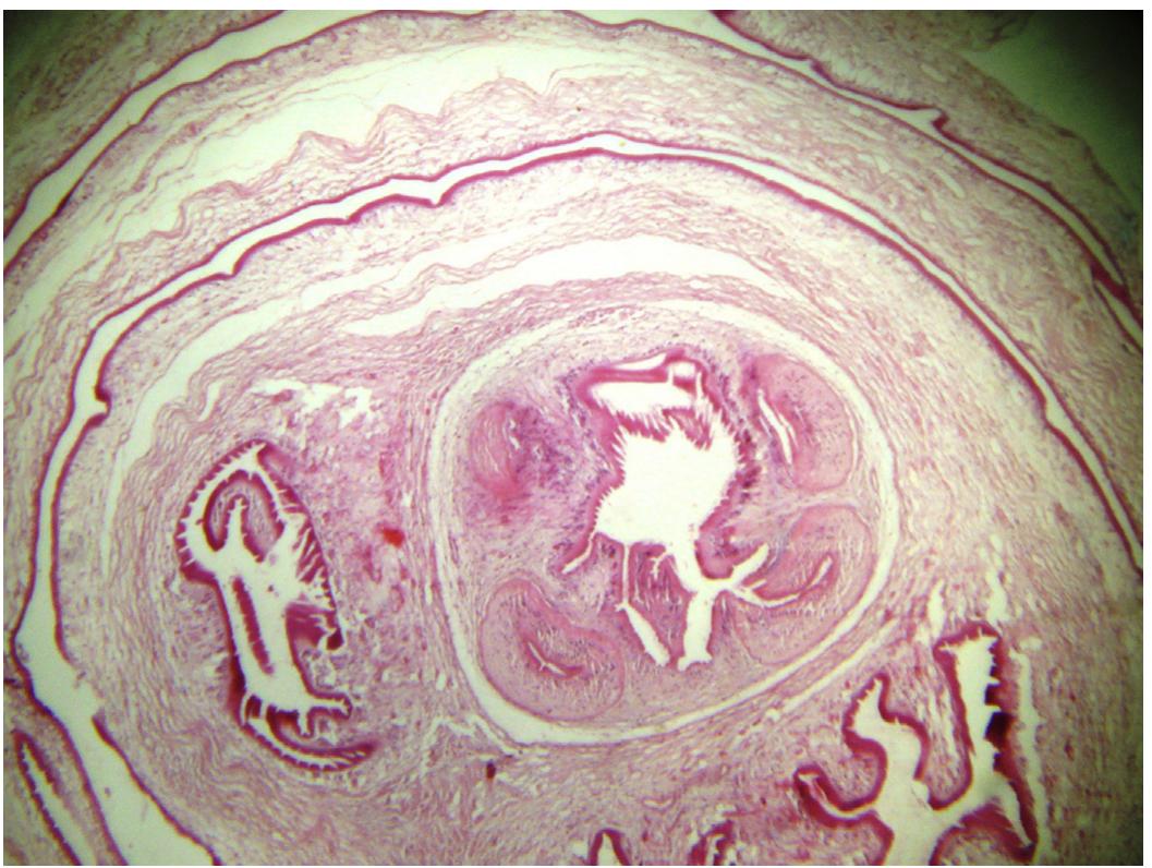Histopathology of a lesion revealing scolex of the larva