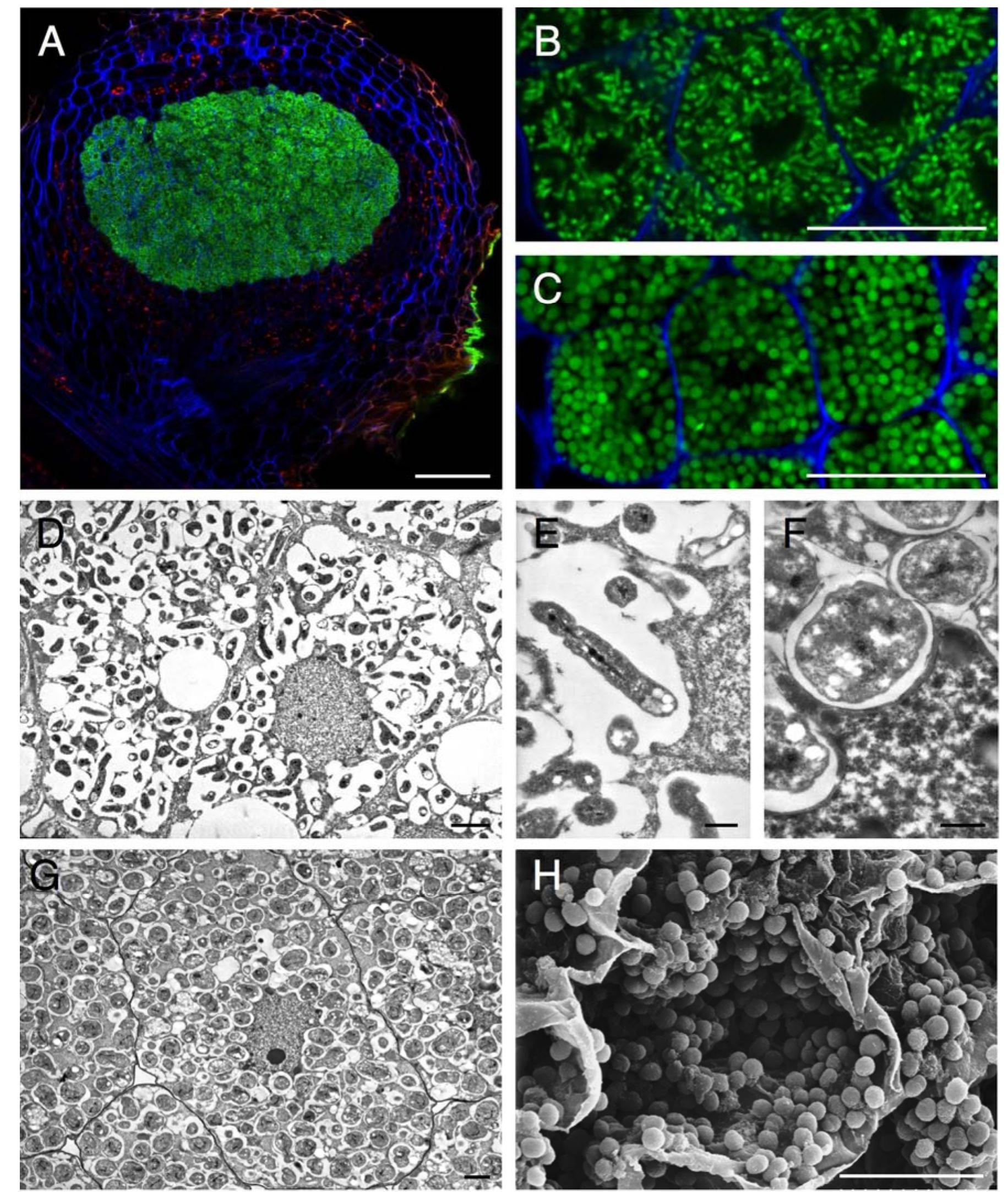 Stages of nodule development in aeschynomene indica elicited