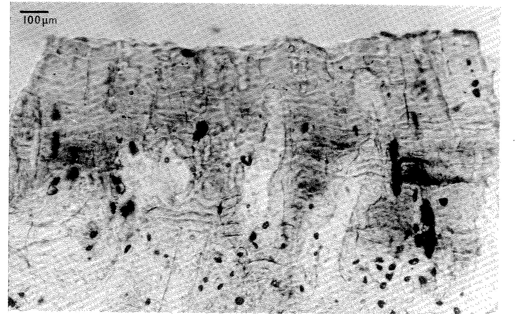 Photomicrograph of sagittal section through the distal
