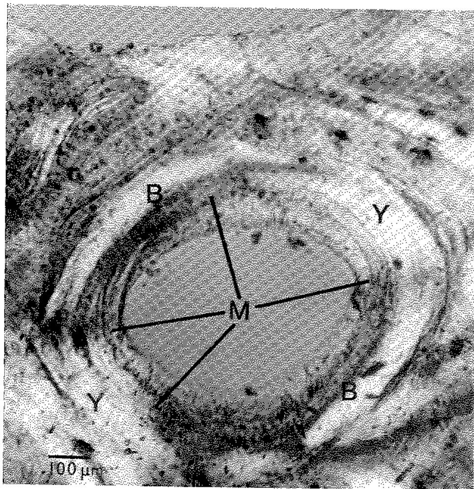 Photomicrograph of sagittal section through the distal