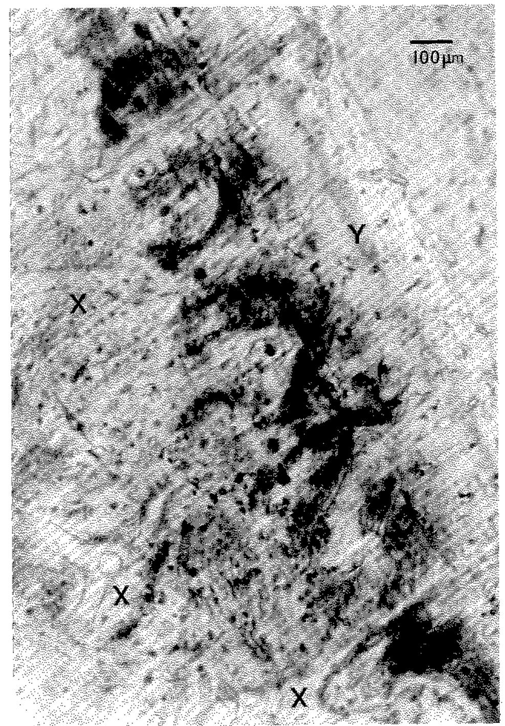 Photomicrograph of transverse section through the distal