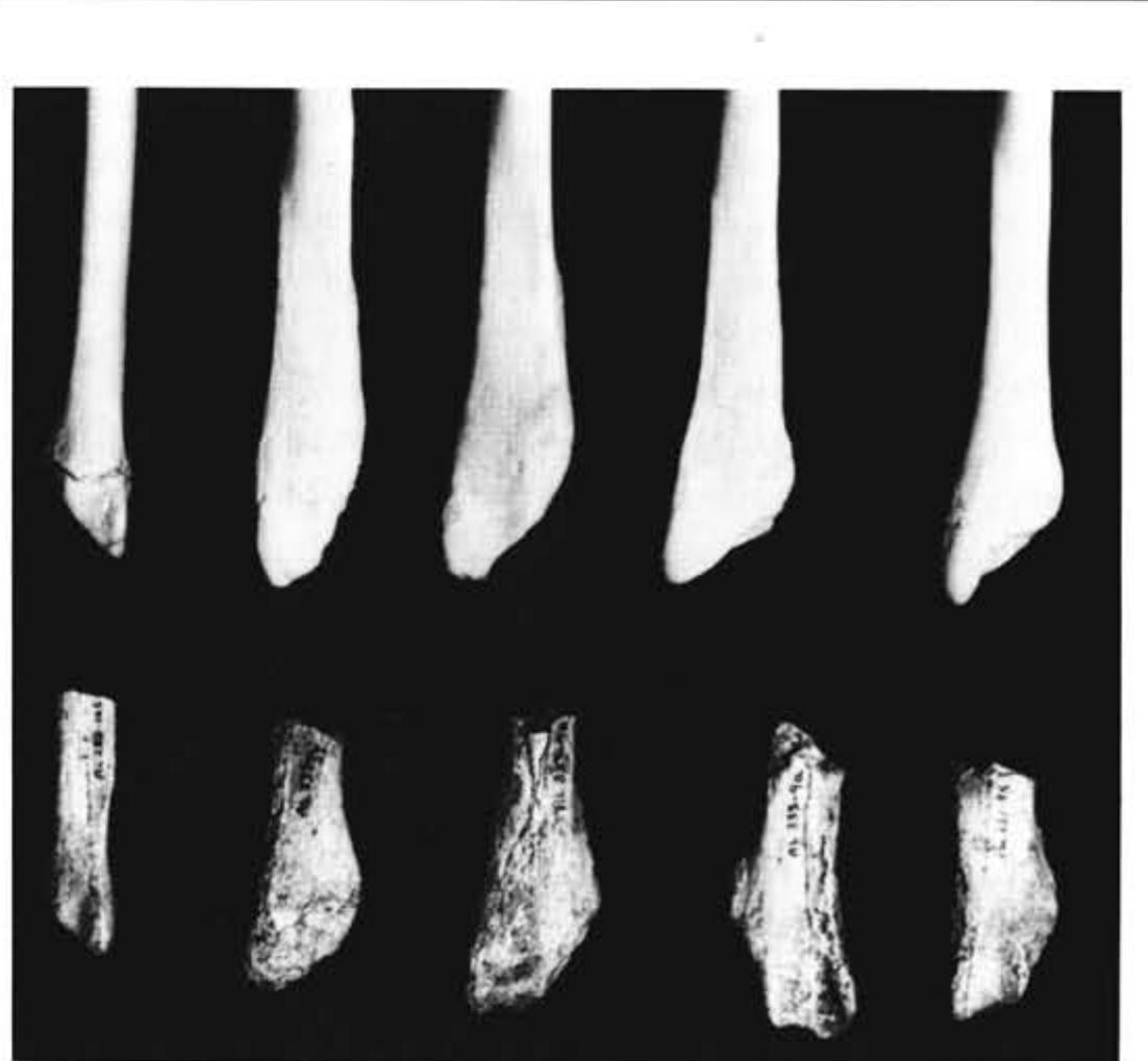 Posterior view of distal fibulae illustrating the peroneal