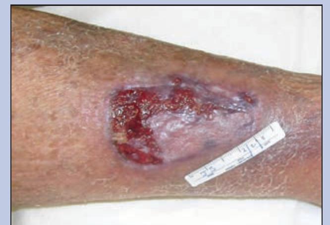 A. digital wound analysis 1/31/11. drawtex week o. the color