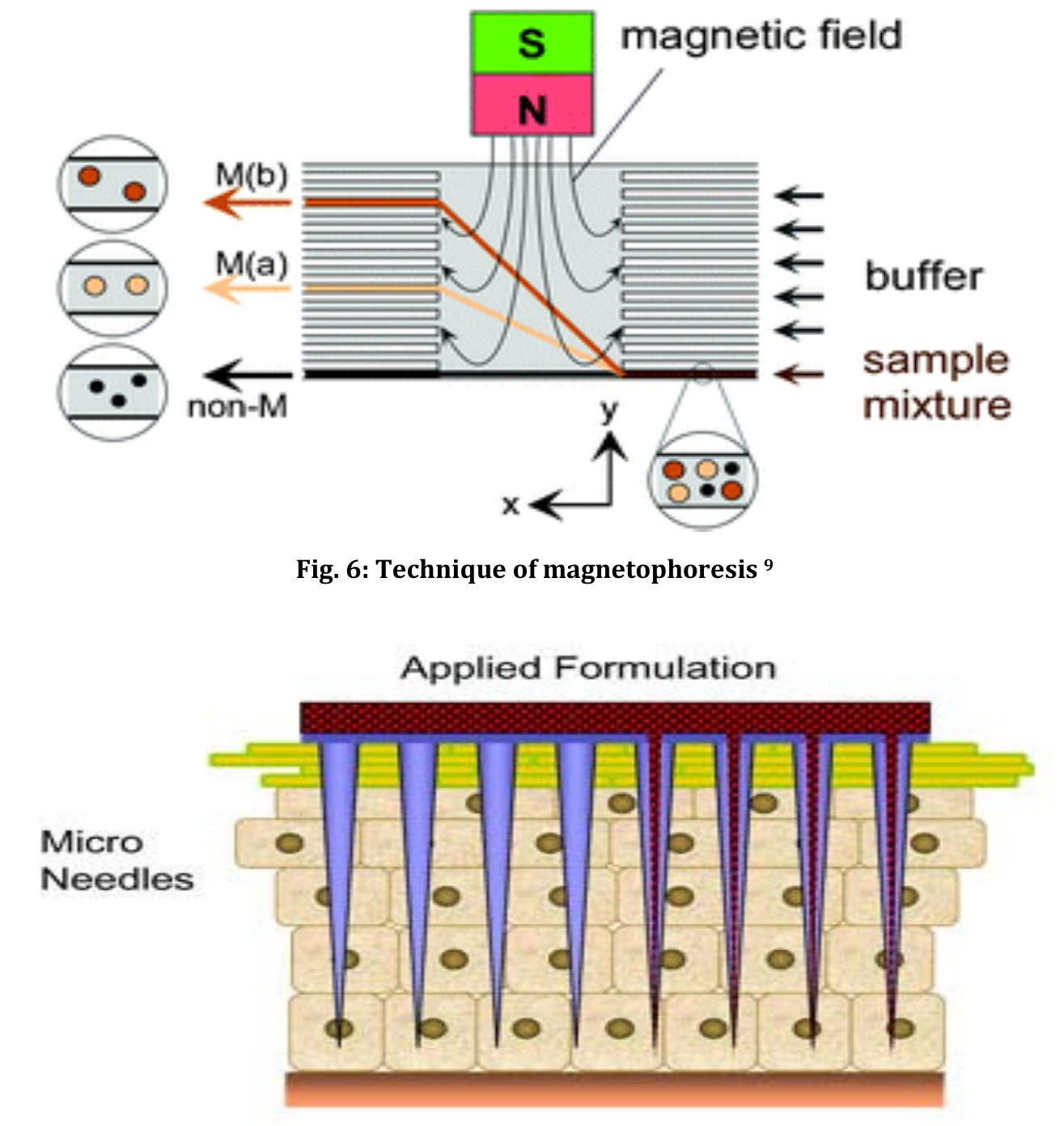 Basic design of micro needle delivery devices 1° 14.