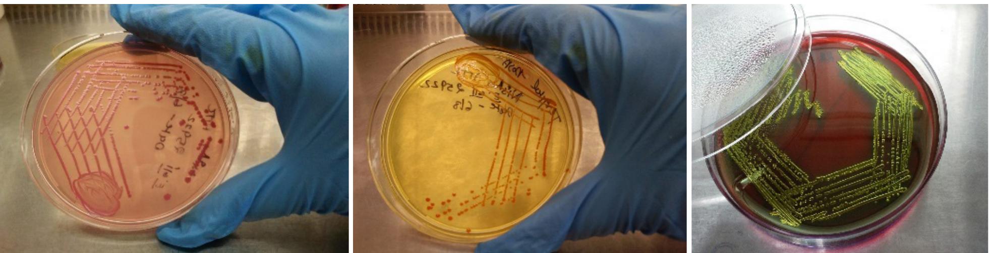 E. colion macconkey agar, tergitol 7 agar and emb agar