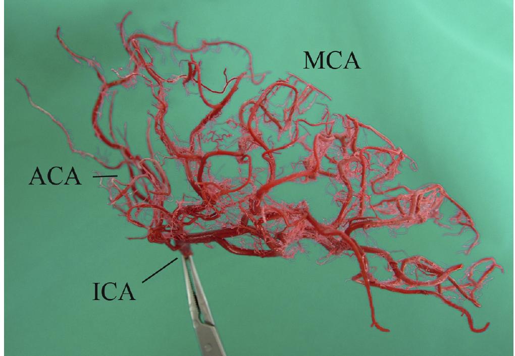 Appearance of the brain arteries after corrosion technique.