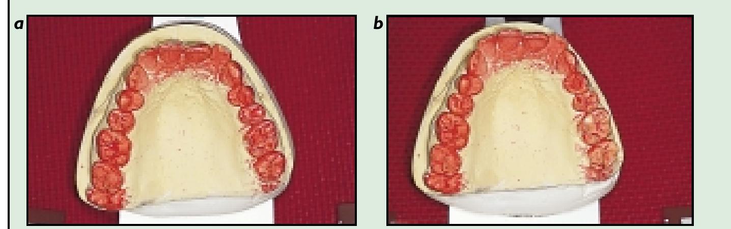 (a, b) painted upper cast before and after identification of