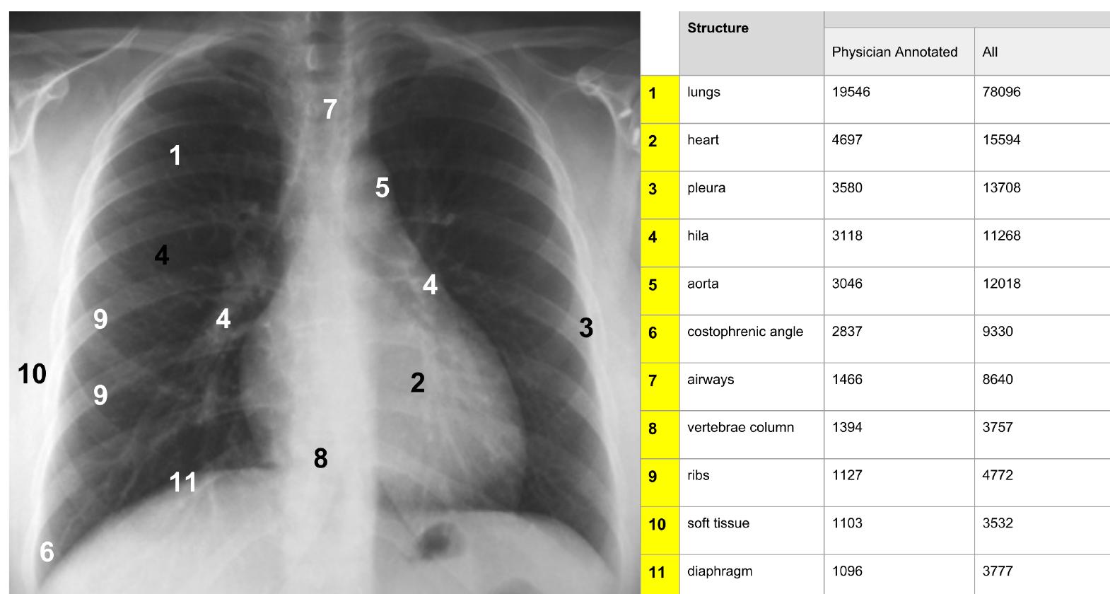 Most common locations of radiographic findings and