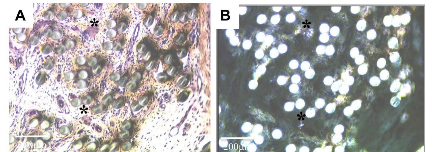 Kinematic analysis. the anterior drawer sign was present in