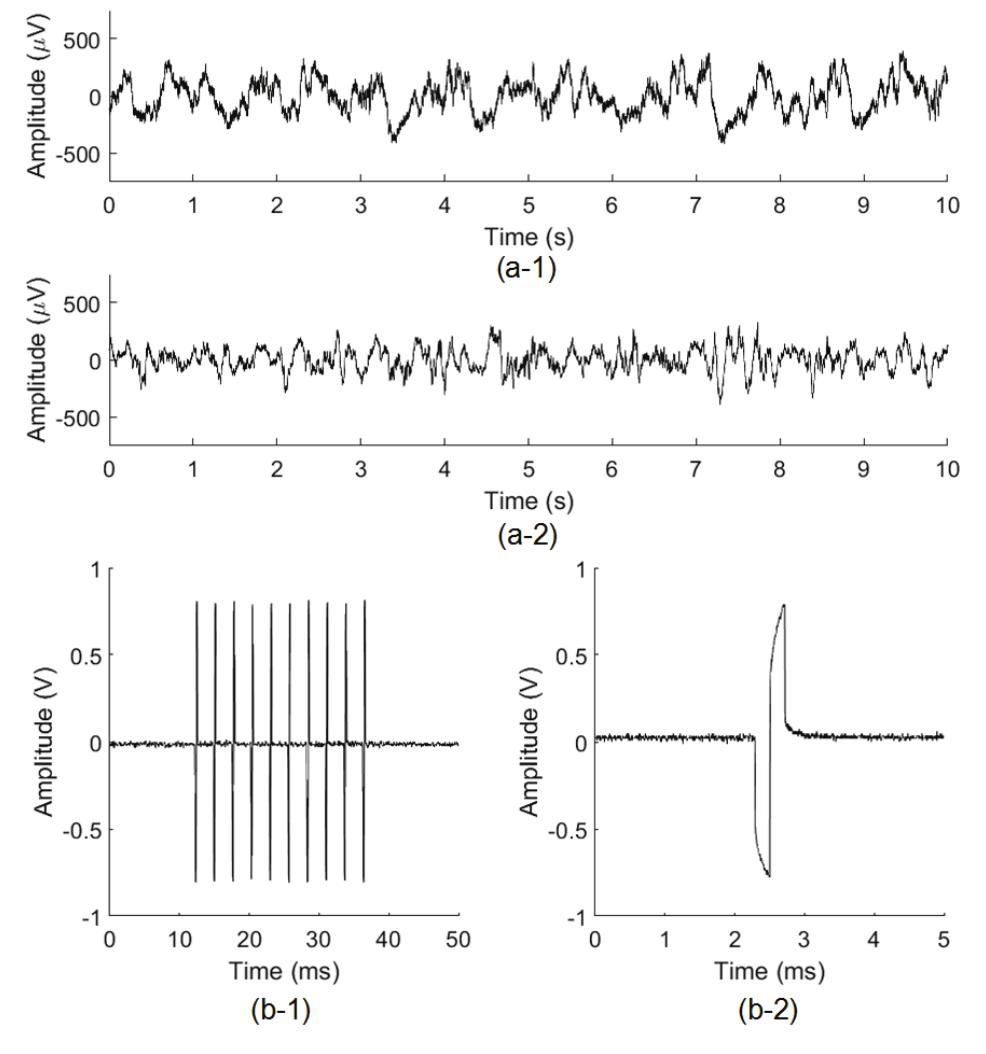 Figure 21 - Design of a Closed-Loop, Bidirectional Brain